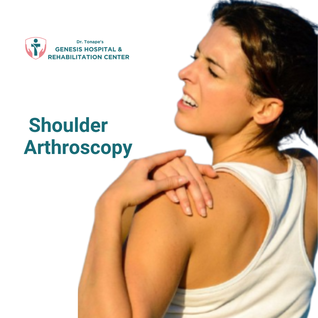 Minimally Invasive Shoulder Arthroscopy : Recovery - Dr. Tonape's ...